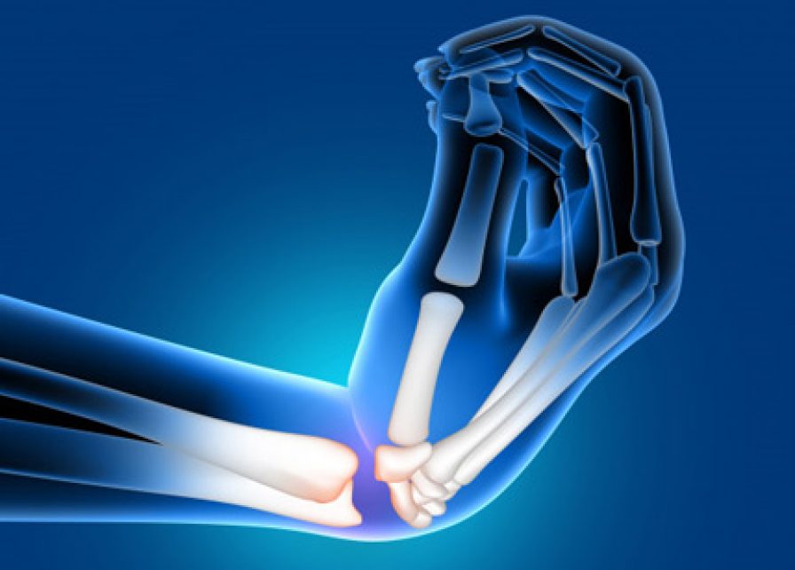 Wrist/Hand - Redefined Health